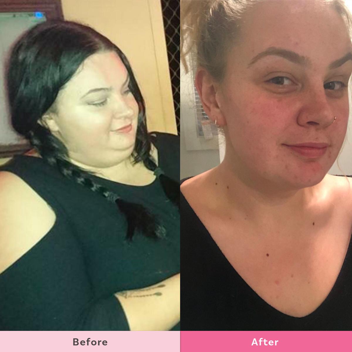 Xanni has overcome depression and anxiety, lost 40 kilos and changed ...